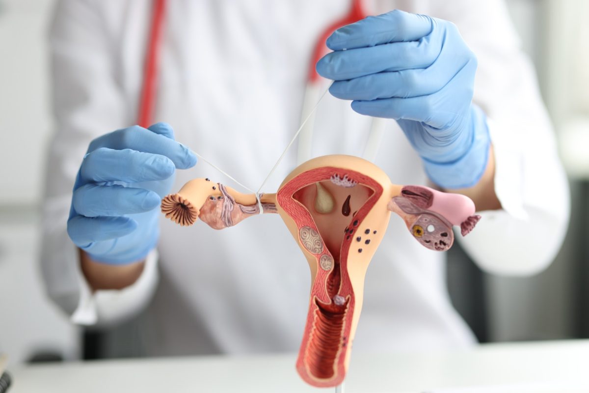 6 Things people with PCOS want you to know - Healthwatch by Shyft
